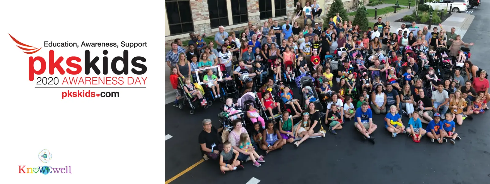 Pallister Killian Syndrome: A Rare Genetic Disorder That Is Life ...