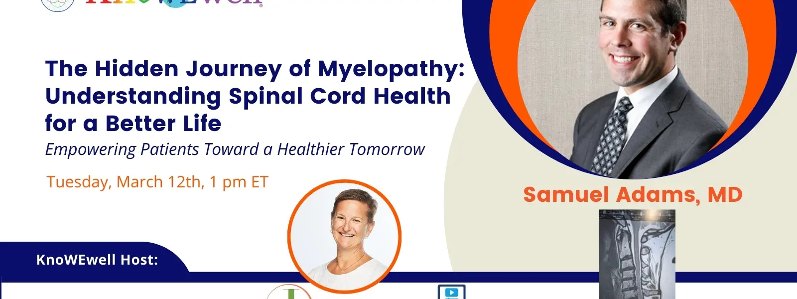The Hidden Journey of Myelopathy: Understanding Spinal Cord Health for ...